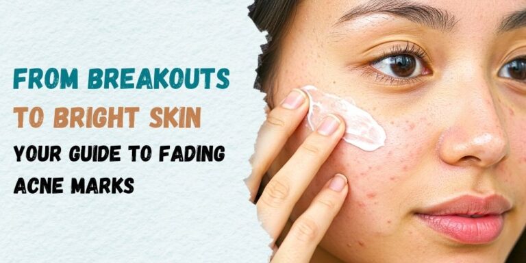 How to Treat Post-Acne Marks | DermaPrecision